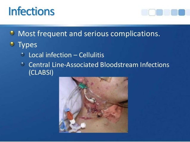 Central Venous Access