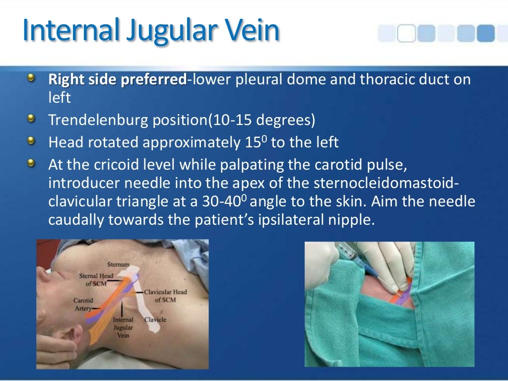 Central Venous Access Central Venous Access