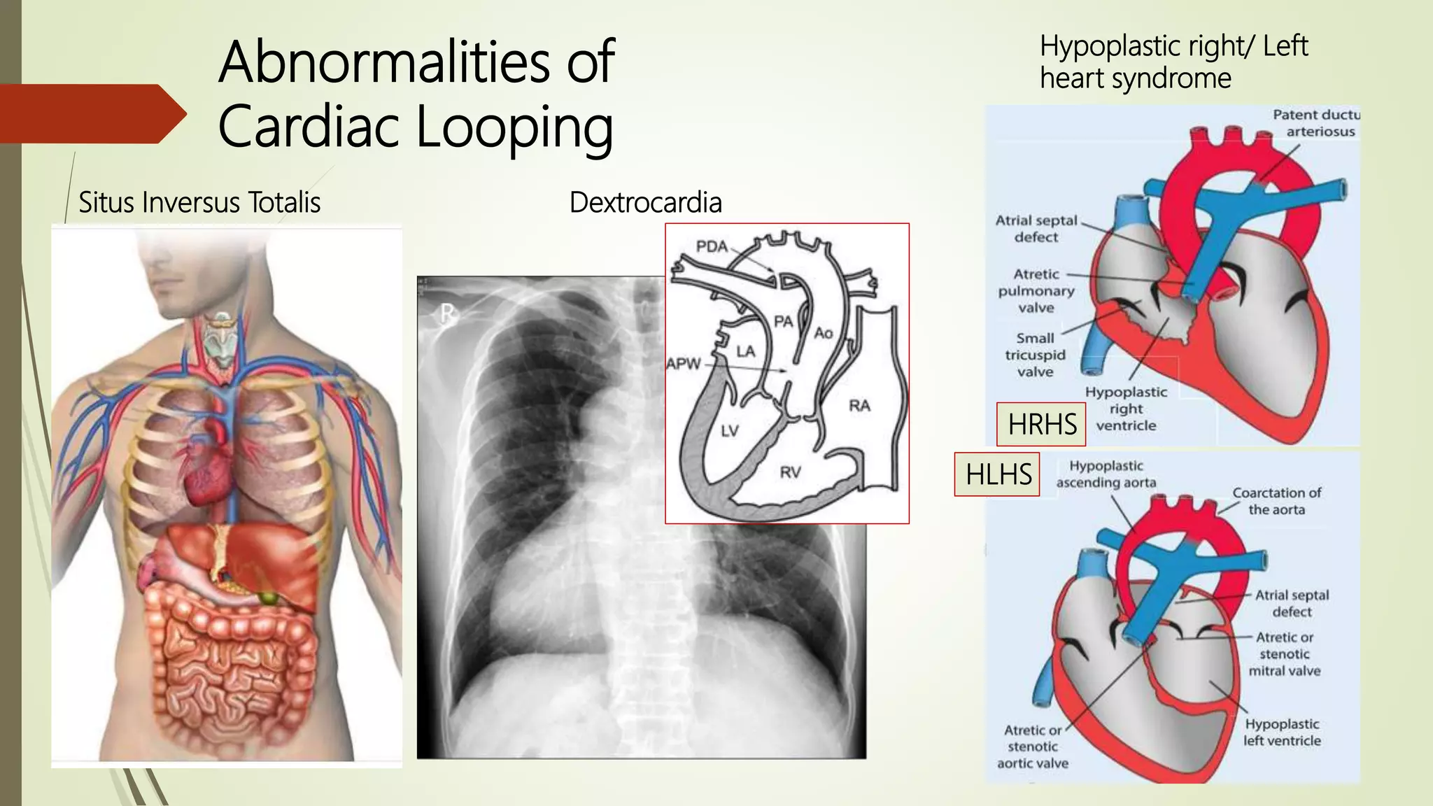 Cardiovascular System Development | PPTX
