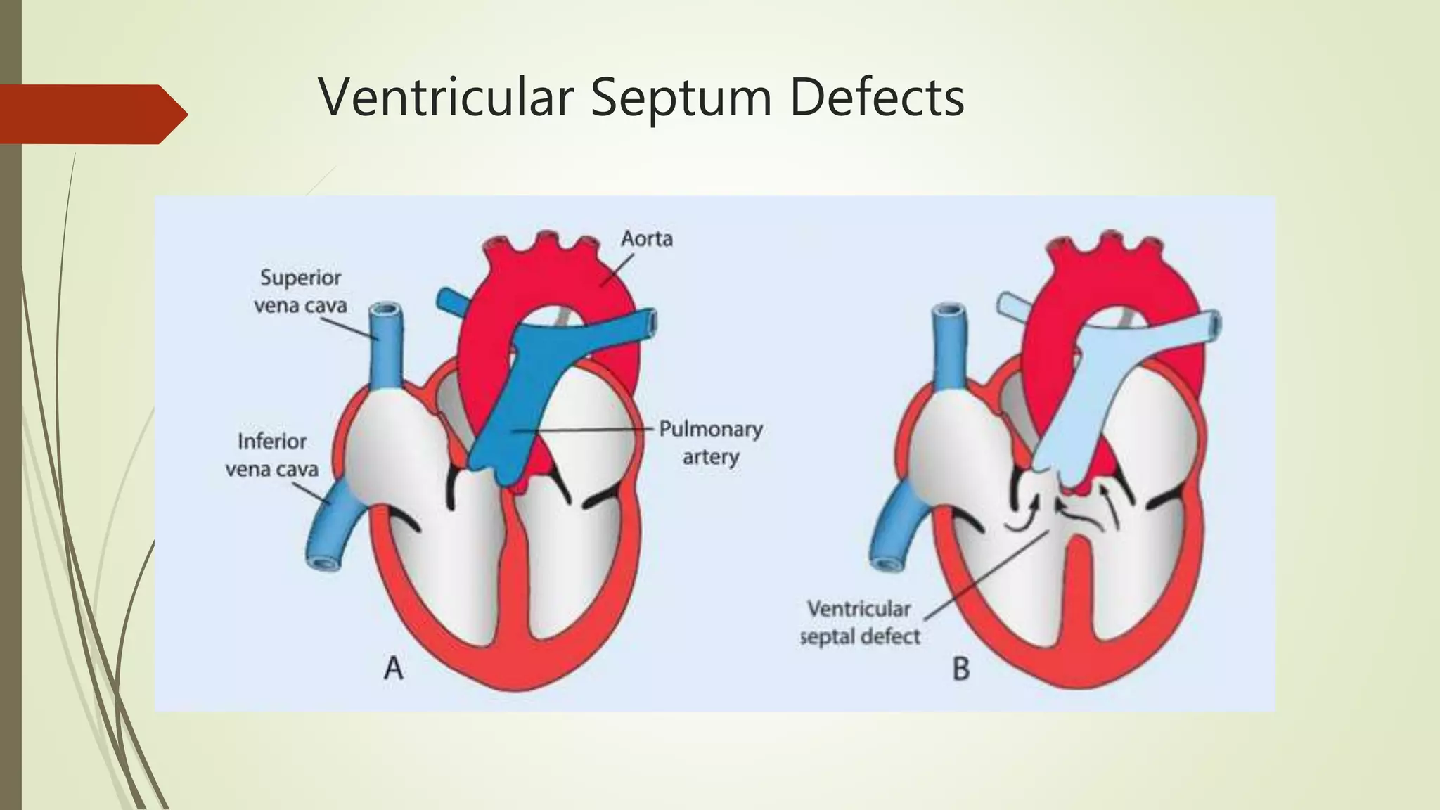 Cardiovascular System Development | PPTX