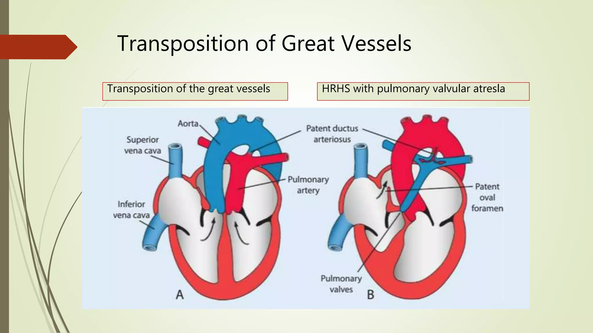 Cardiovascular System Development | PPTX