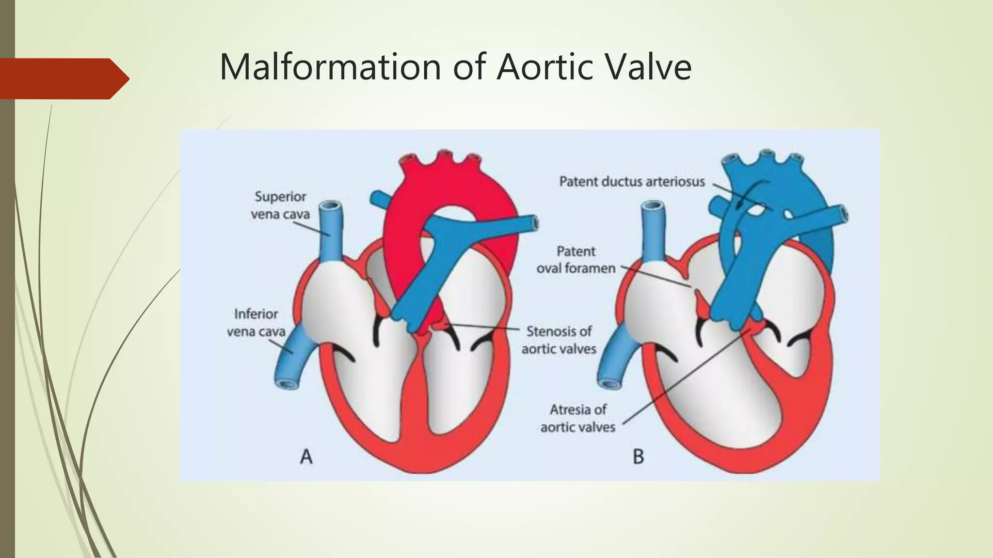 Cardiovascular System Development | PPTX