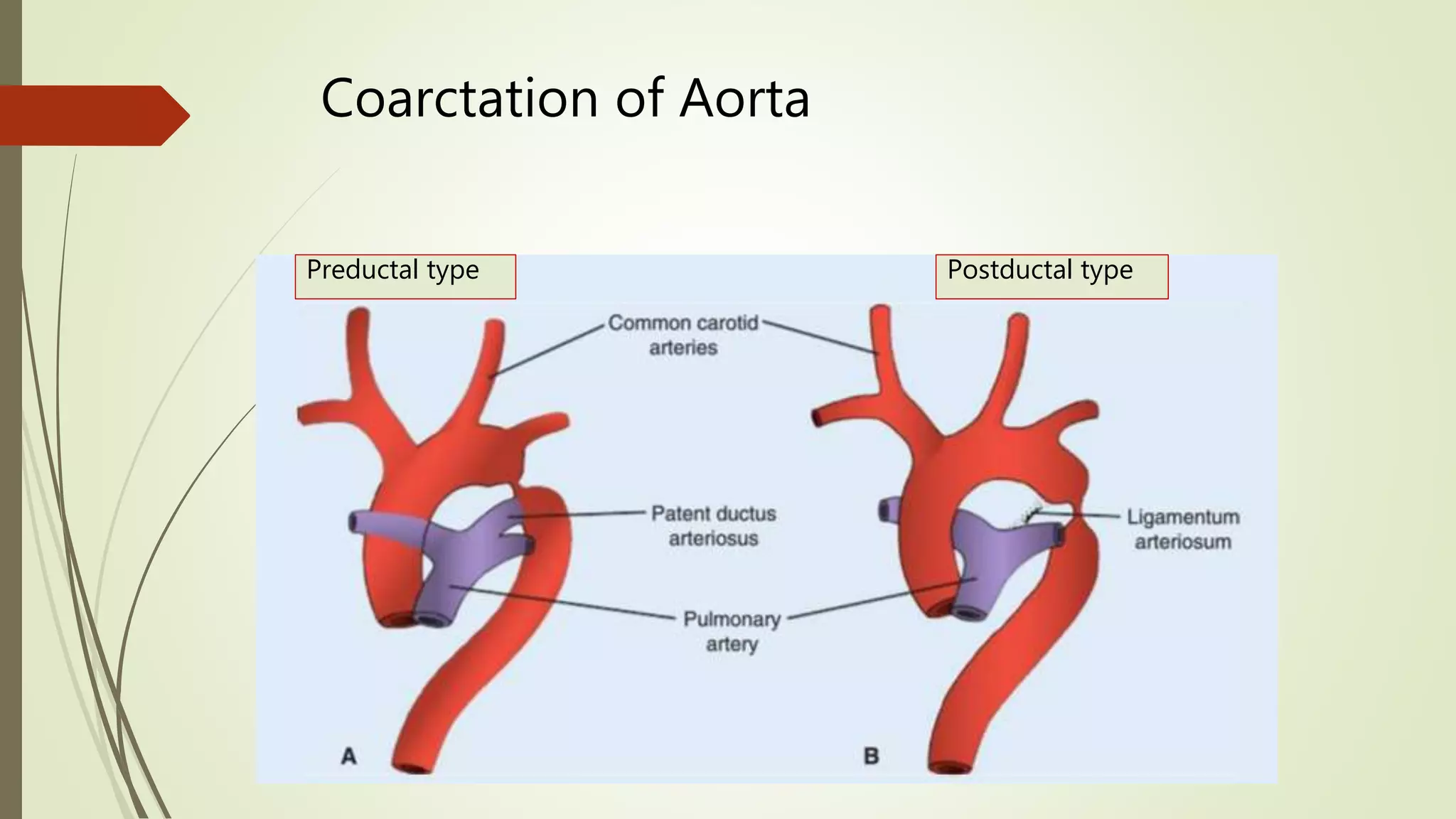 Cardiovascular System Development | PPTX