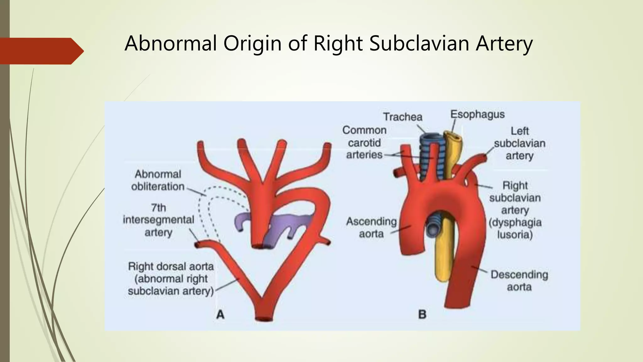 Cardiovascular System Development | PPTX