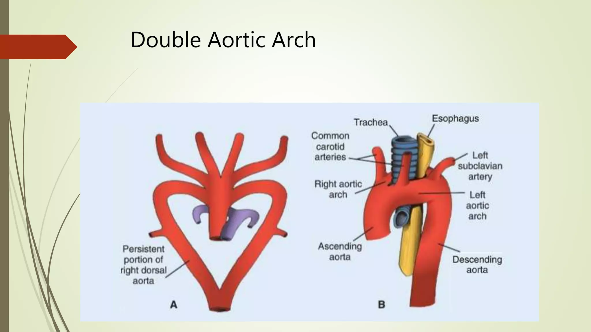 Cardiovascular System Development | PPTX