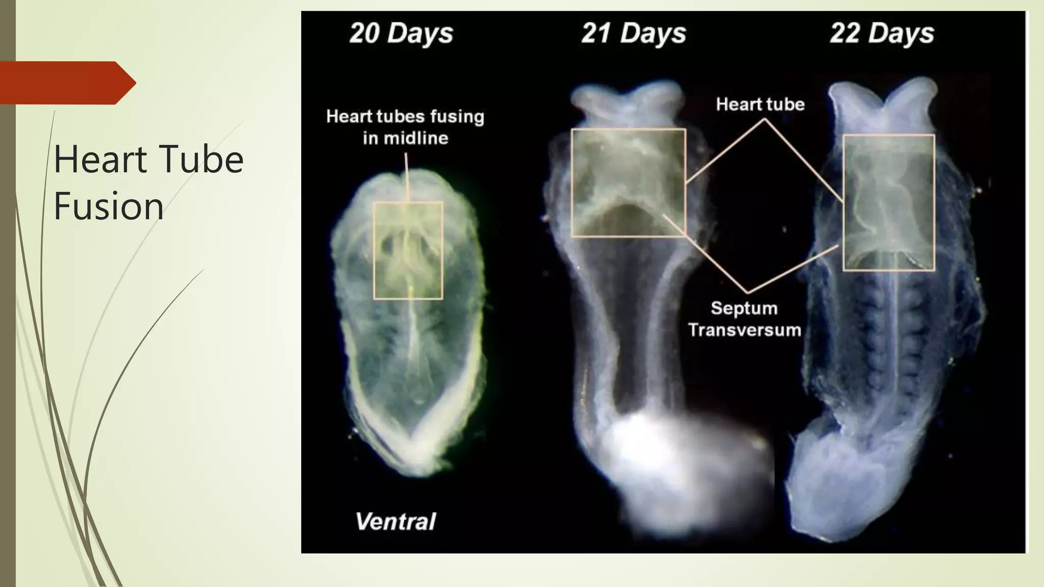 Cardiovascular System Development | PPTX