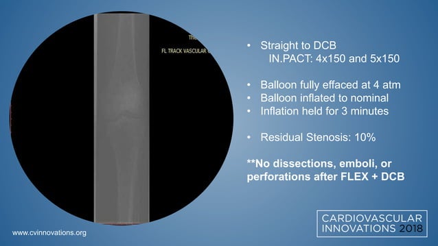 A Tale of Two Lesions, CVI 2018 | PPT