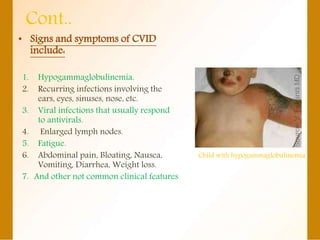 COMMON VARIABLE IMMUNODEFICIENCY (CVID) | PPT | Free Download