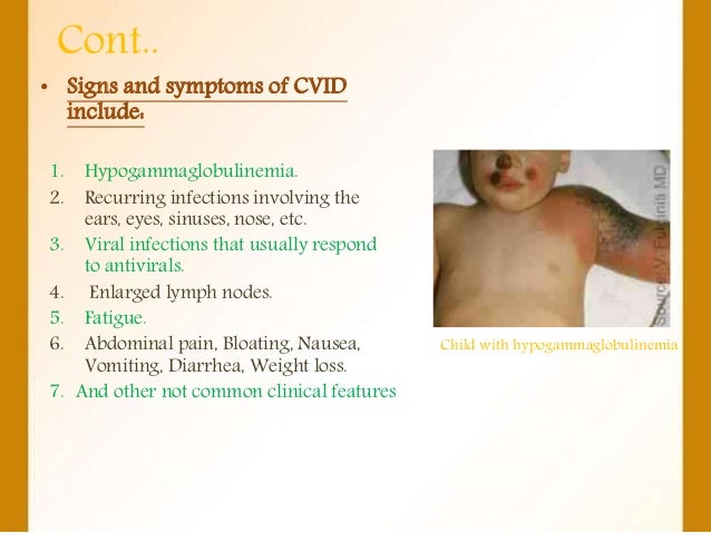COMMON VARIABLE IMMUNODEFICIENCY (CVID)