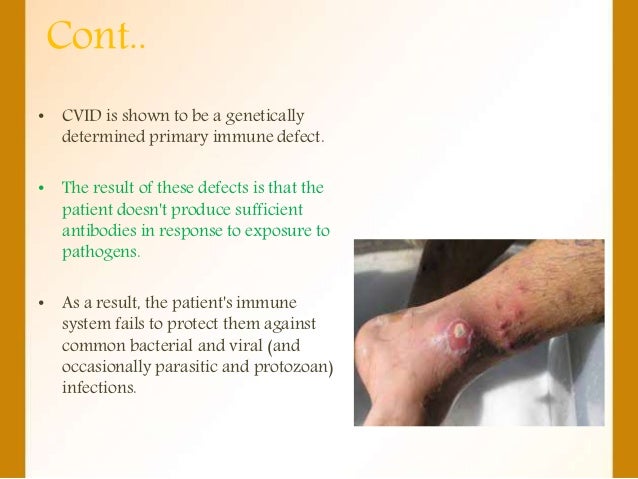 Images of CVID - JapaneseClass.jp