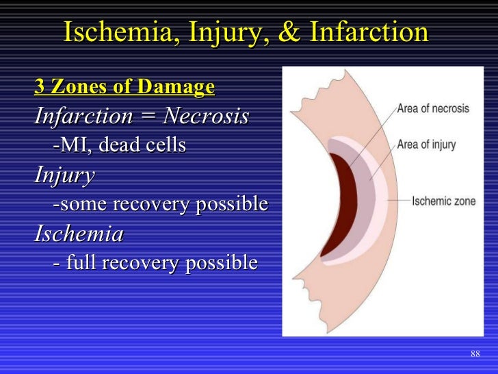 Cv ii patho pharm fall 11