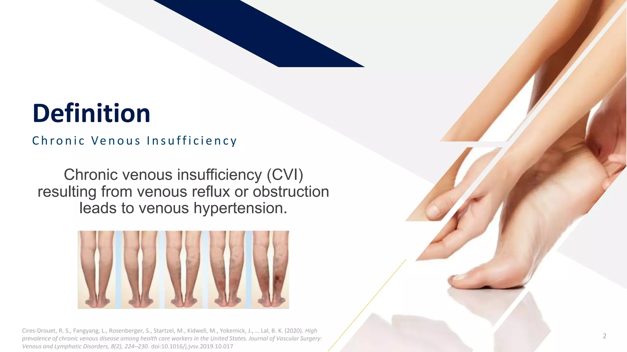 chronic venous insufficiency | PPT