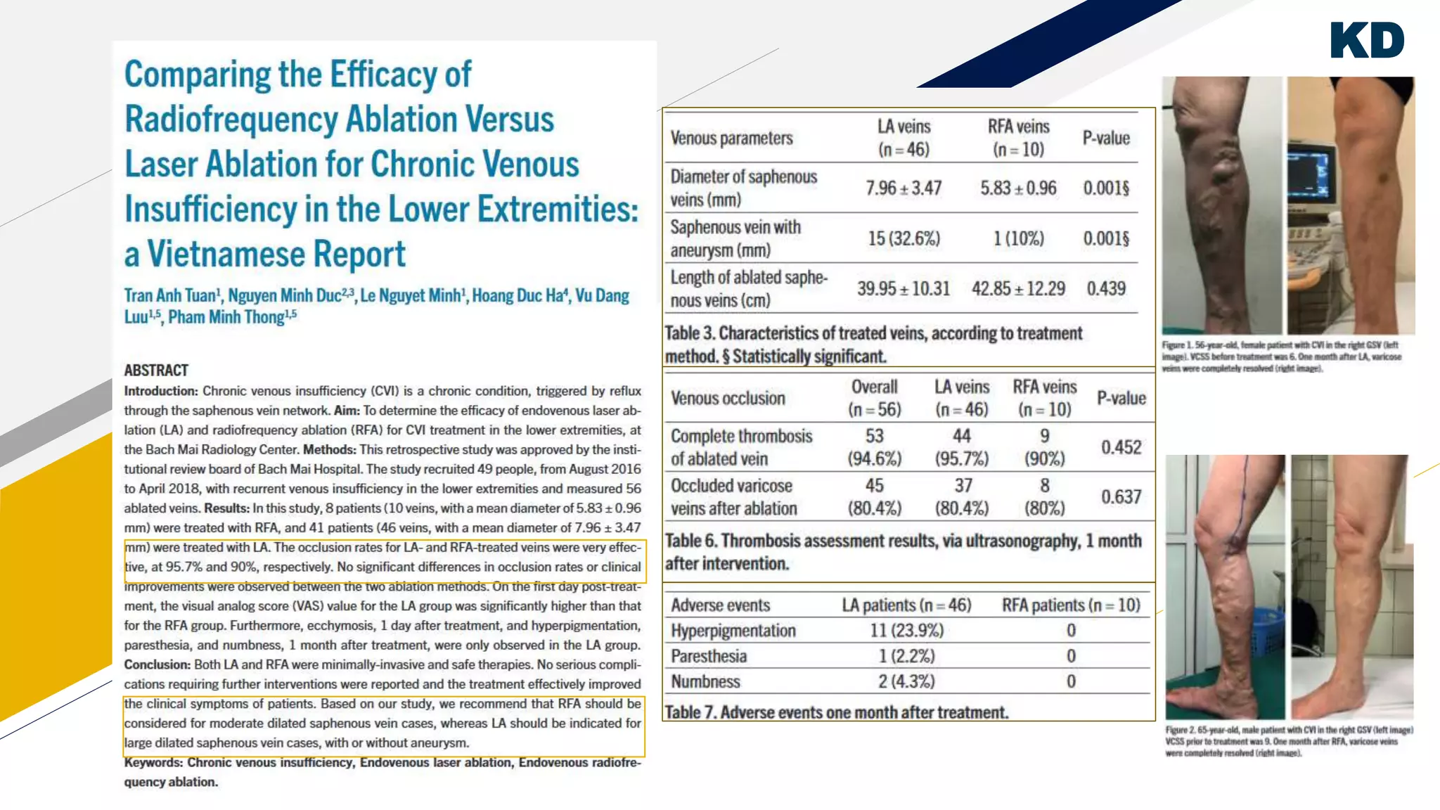 chronic venous insufficiency | PPTX
