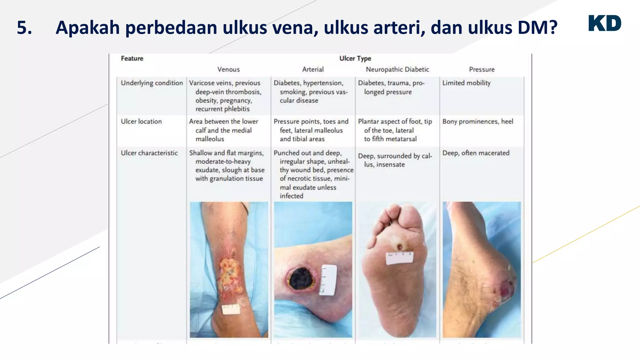 chronic venous insufficiency | PPTX