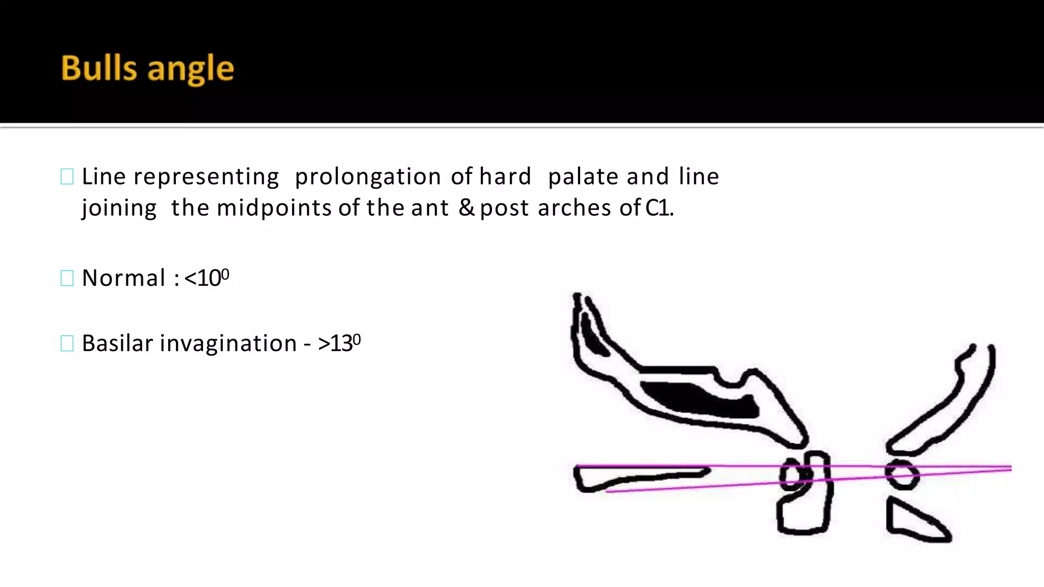 Cranio vertebral junction anomalies | PPTX