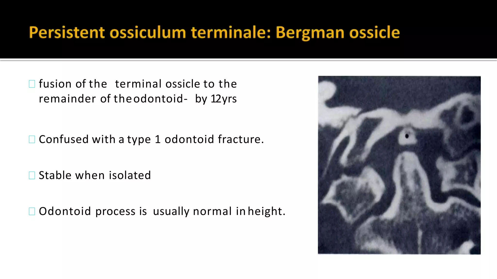 Cranio vertebral junction anomalies | PPTX