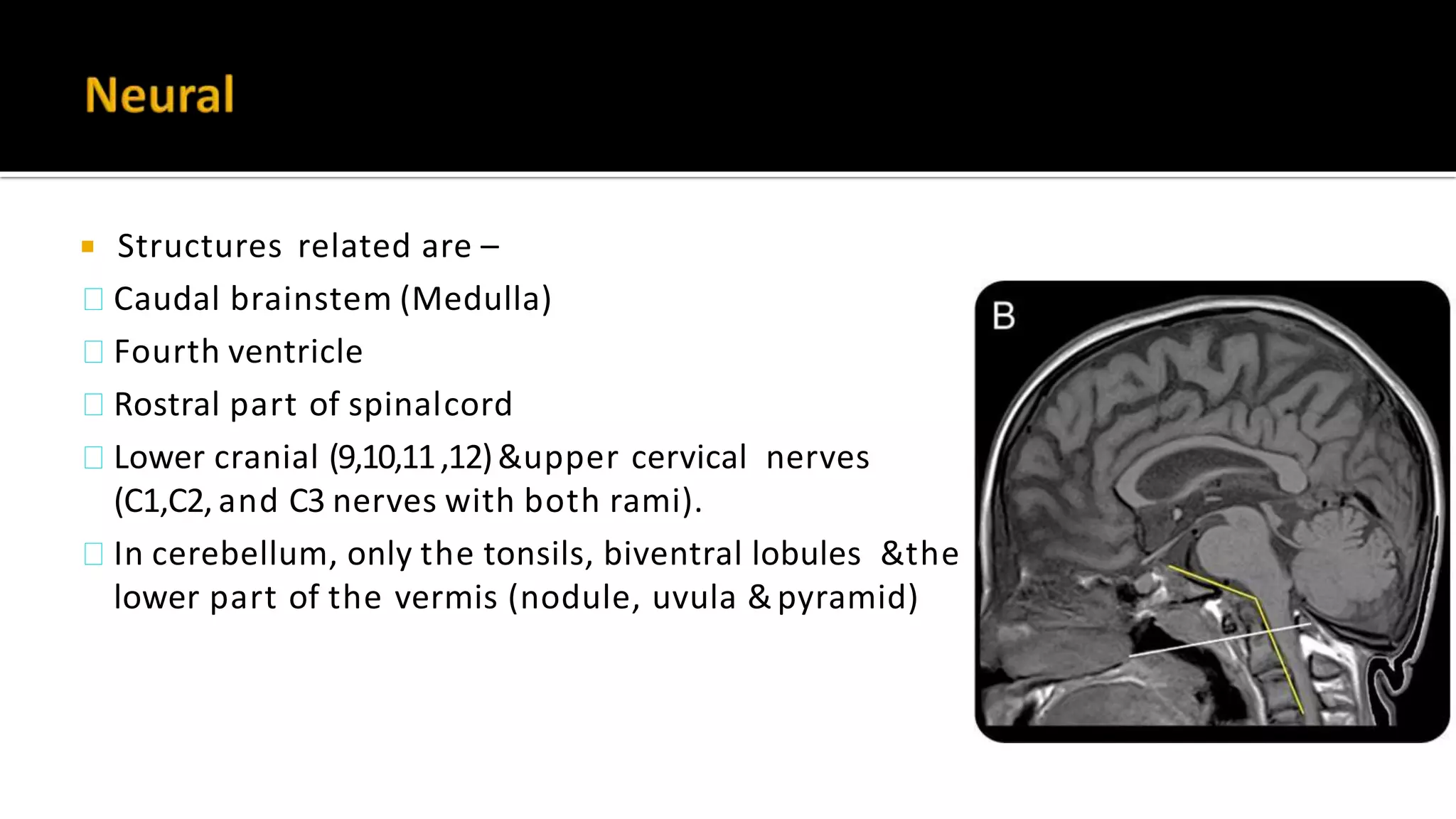Cranio vertebral junction anomalies | PPTX