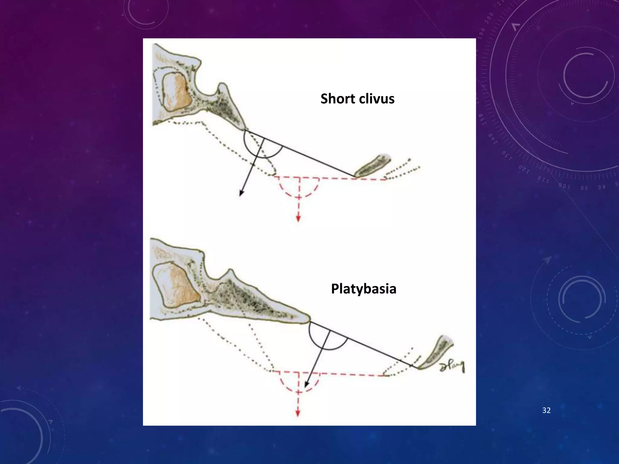 Imaging in CranioVertebral Junction Anomalies | PPTX