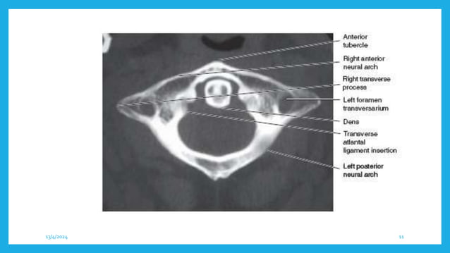 CRANIO VERTEBRAL JUNCTION RADIOLOGICAL ANATOMY .pptx
