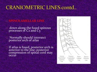 Cranio-vertrable junction anamolies | PPTX