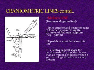 Cranio-vertrable junction anamolies | PPTX