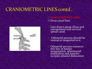 Cranio-vertrable junction anamolies | PPTX