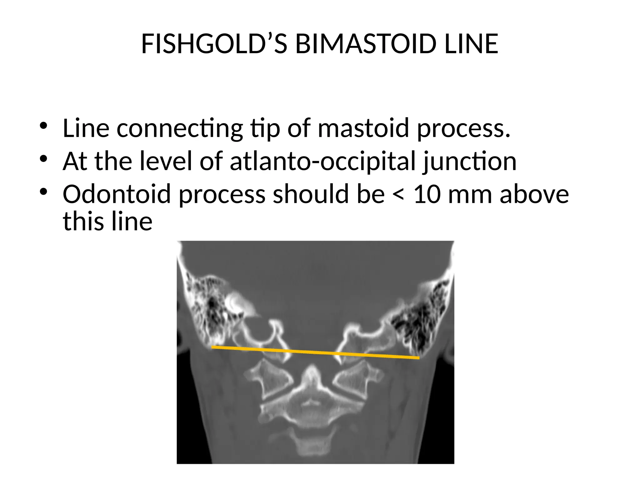 CVJ ANOMALIES RJJ.powerpoint presentation | PPTX