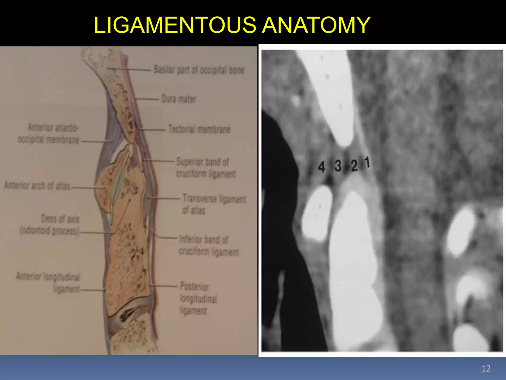 imaging of the craniovertebral junction | PPTX