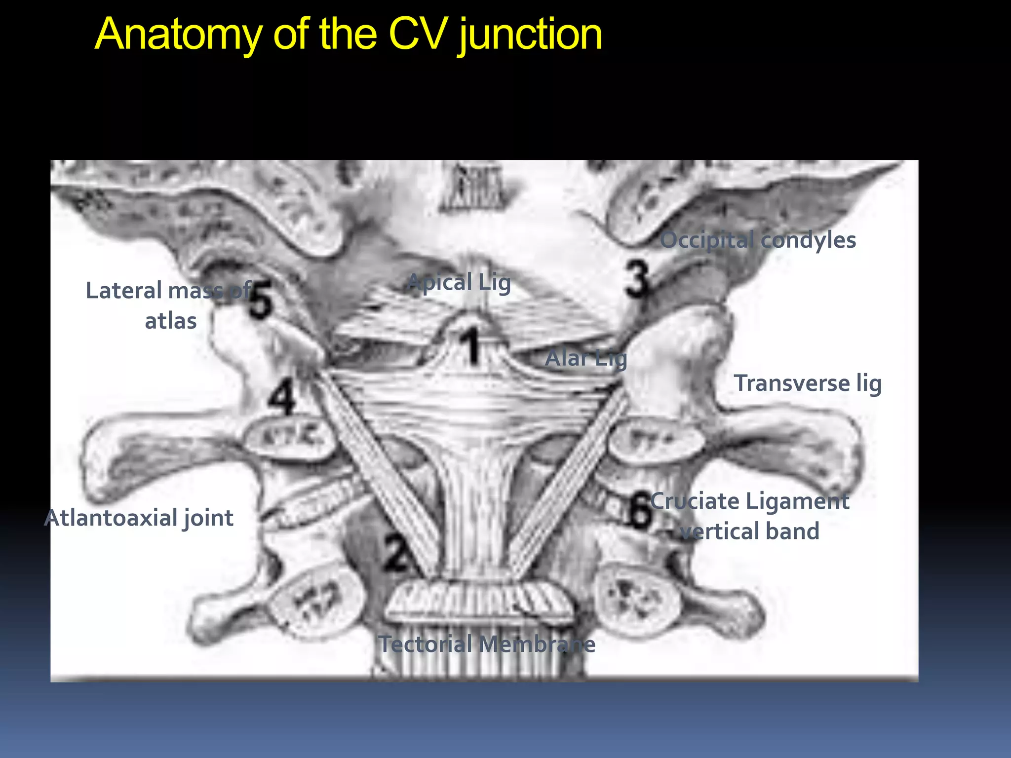 imaging of the craniovertebral junction | PPTX
