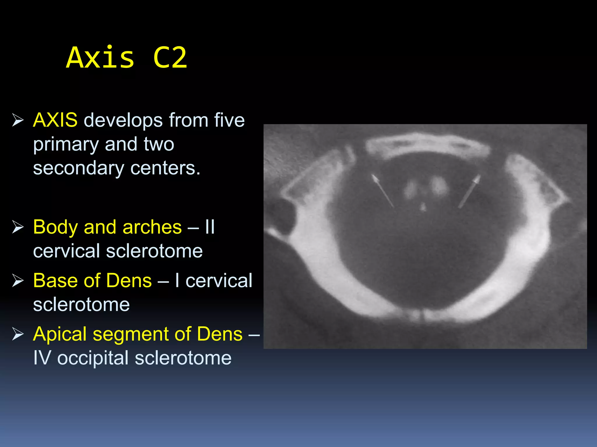 imaging of the craniovertebral junction | PPTX