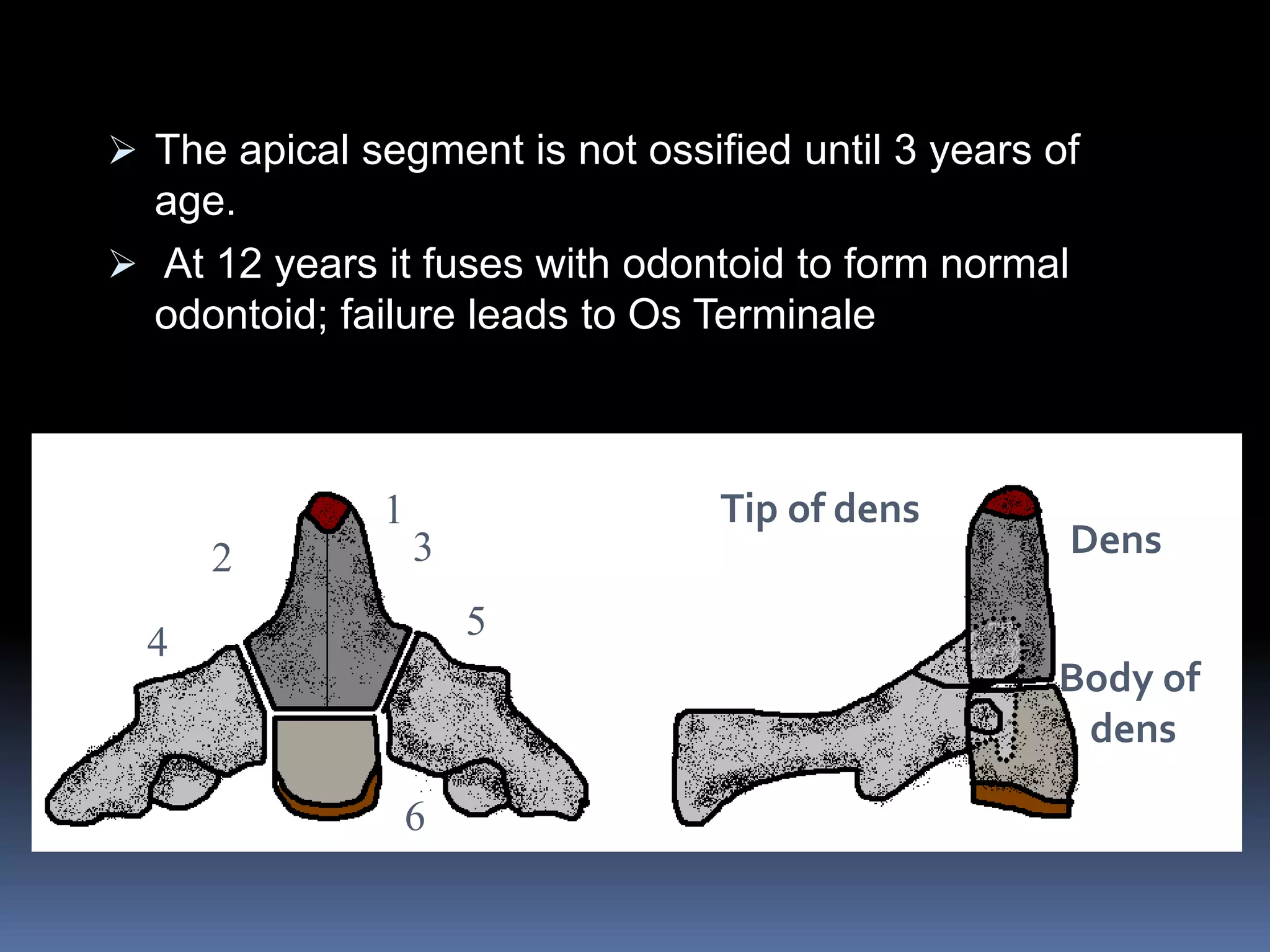imaging of the craniovertebral junction | PPTX
