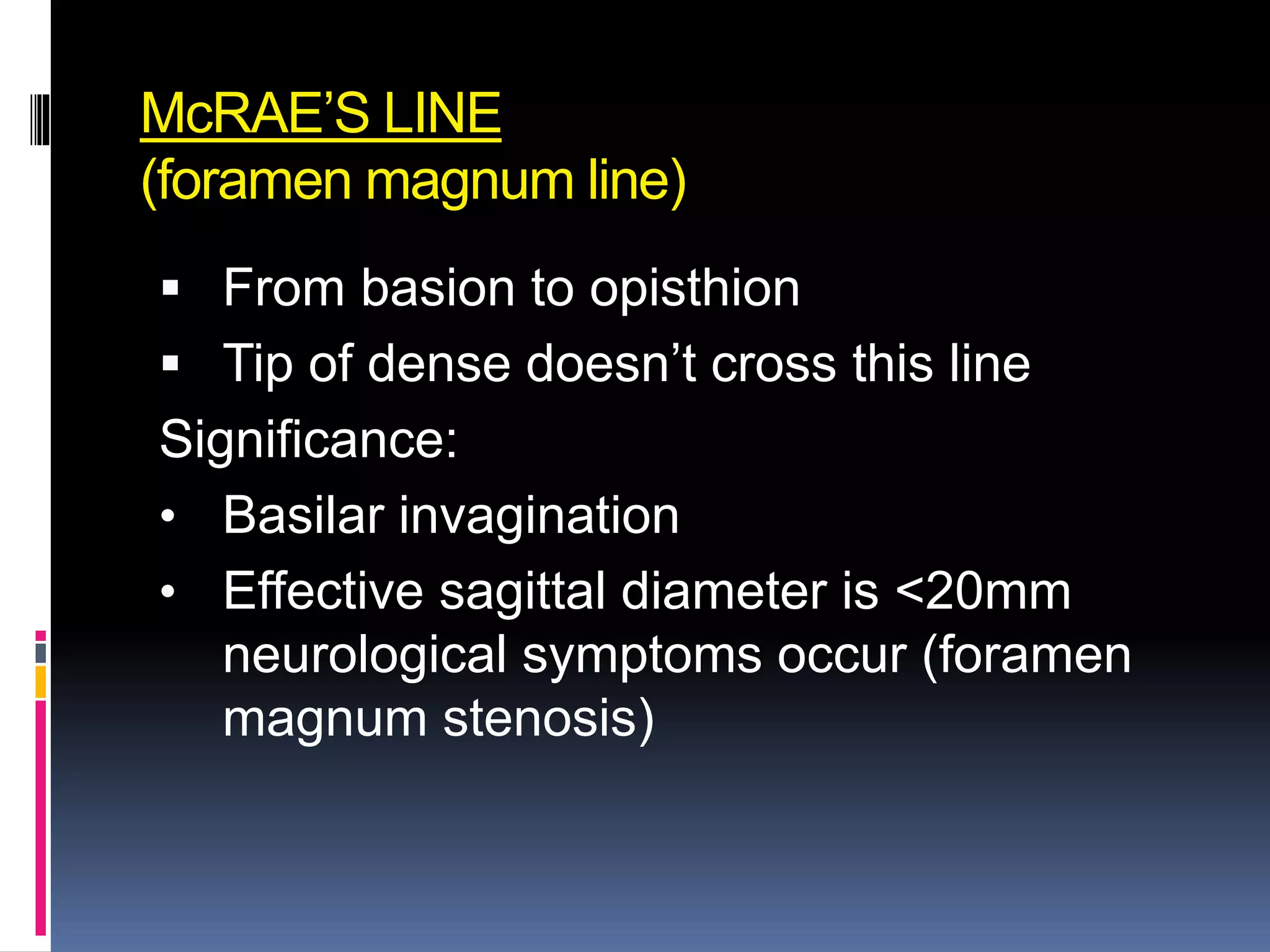 imaging of the craniovertebral junction | PPTX