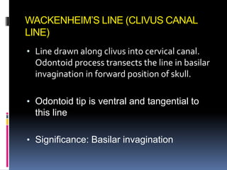 imaging of the craniovertebral junction | PPTX