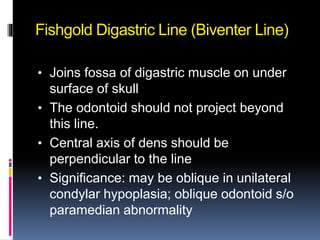 imaging of the craniovertebral junction | PPTX