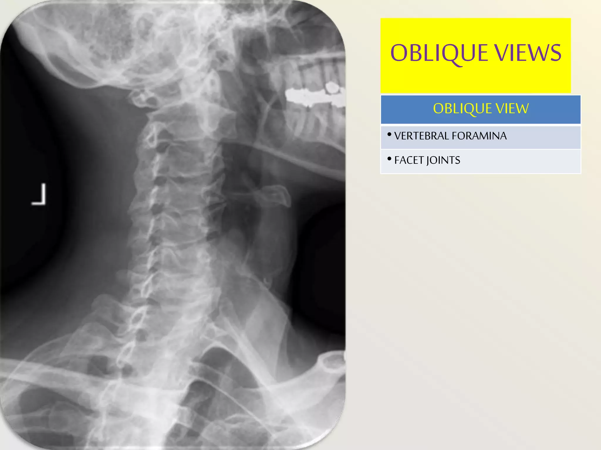 cvj radiology BY DR GAURAV CHAUHAN | PPTX