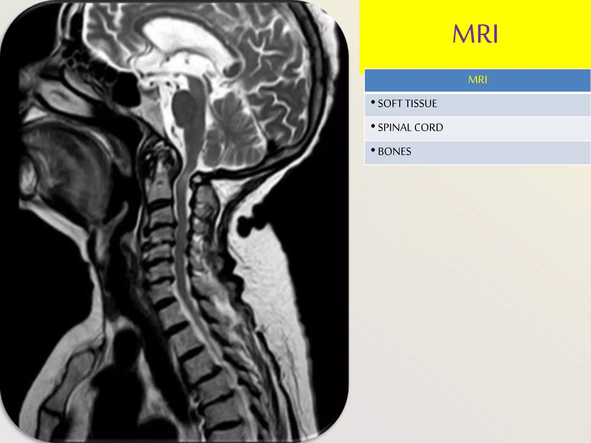 cvj radiology BY DR GAURAV CHAUHAN | PPTX