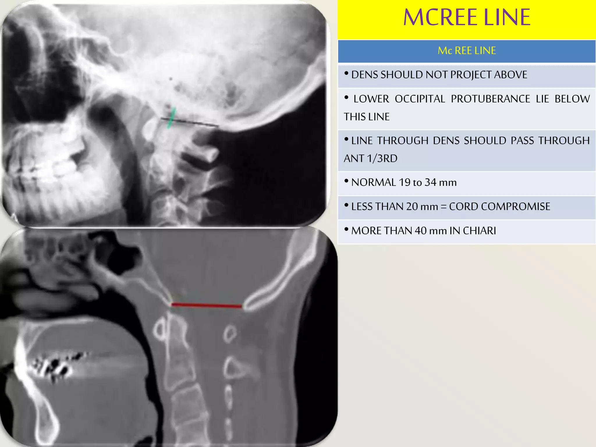 cvj radiology BY DR GAURAV CHAUHAN | PPTX