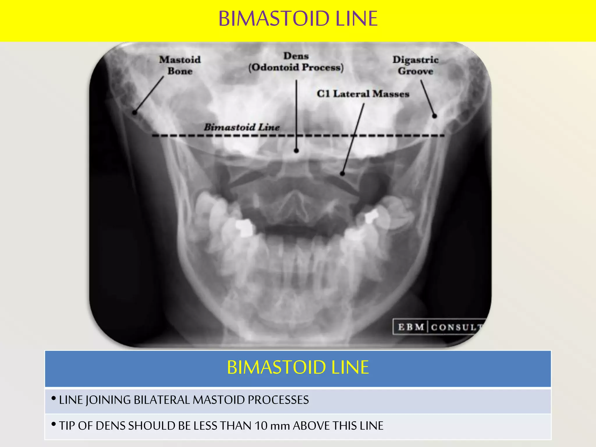 cvj radiology BY DR GAURAV CHAUHAN | PPTX