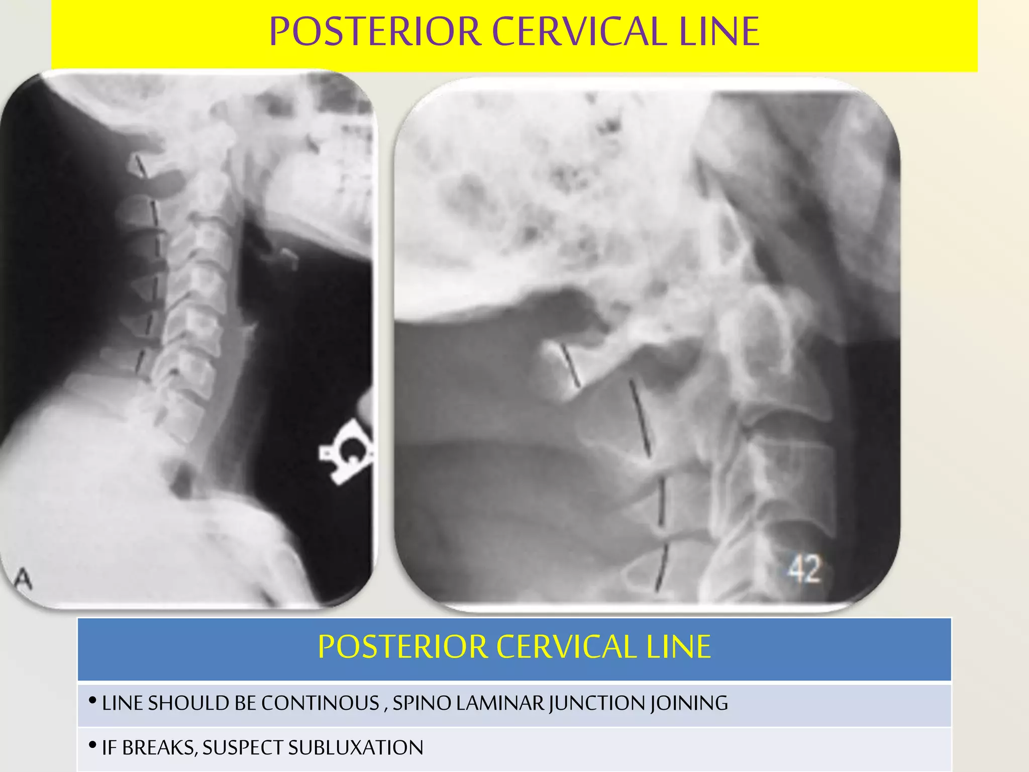 cvj radiology BY DR GAURAV CHAUHAN | PPTX