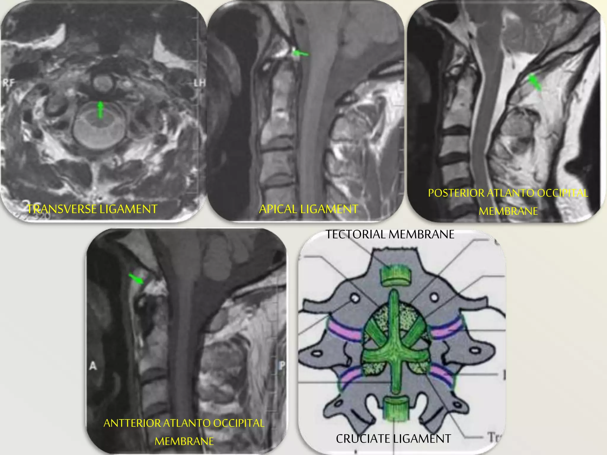 cvj radiology BY DR GAURAV CHAUHAN | PPTX
