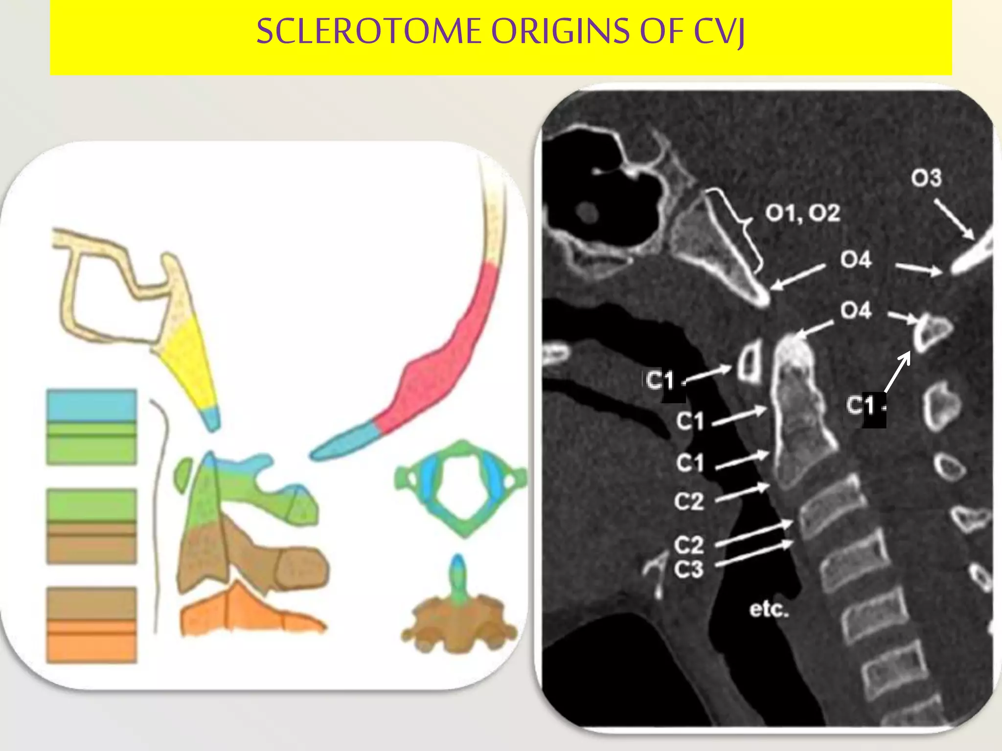 cvj radiology BY DR GAURAV CHAUHAN | PPTX
