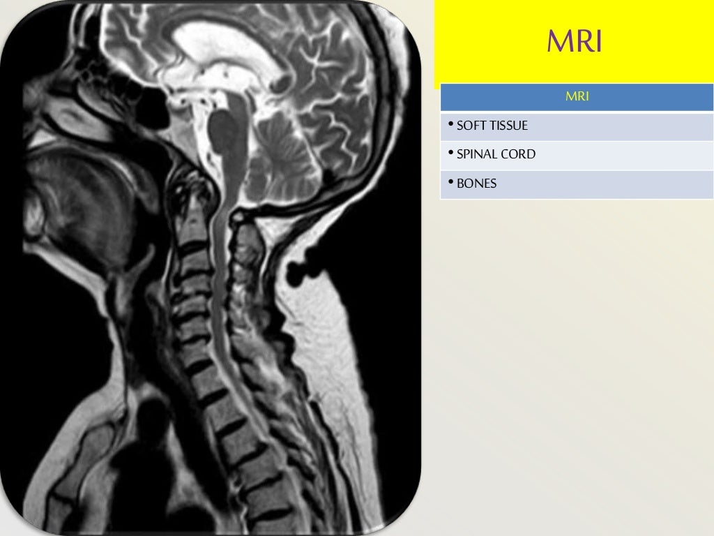 cvj radiology BY DR GAURAV CHAUHAN