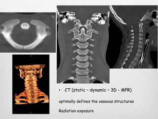 Instability of the cranio-vertebral junction (CVJ) | PPTX