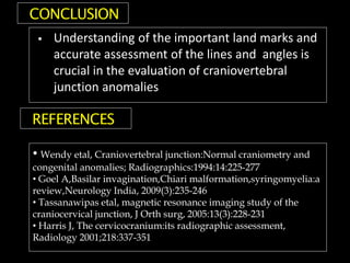 CVJ lines and angles.pdf