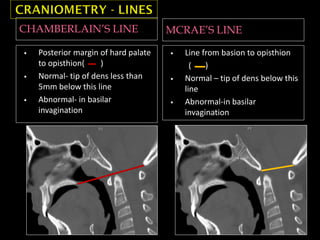 CVJ lines and angles.pdf