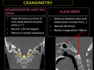 CVJ lines and angles.pdf