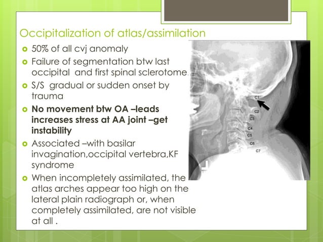 CV junction | PPTX | Death, Injury, or Military Conflict | Sensitive Topics