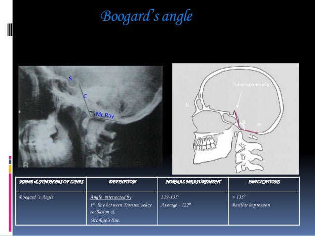 Cvjunction-craniometry