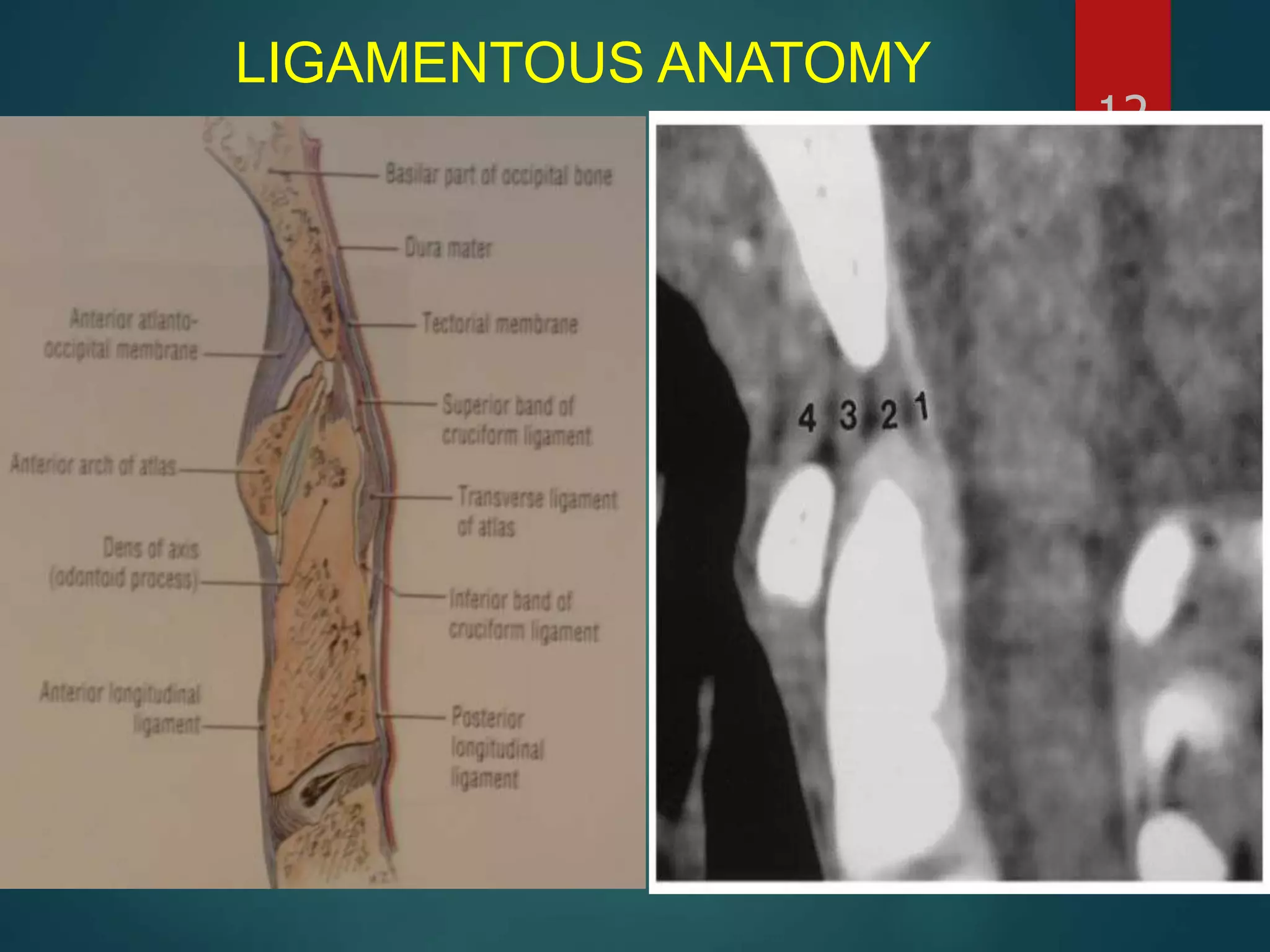 CRANIOVERTEBRAL JUNCTION ANATOMY, CRANIOMETRY, ANAMOLIES AND RADIOLOGY ...