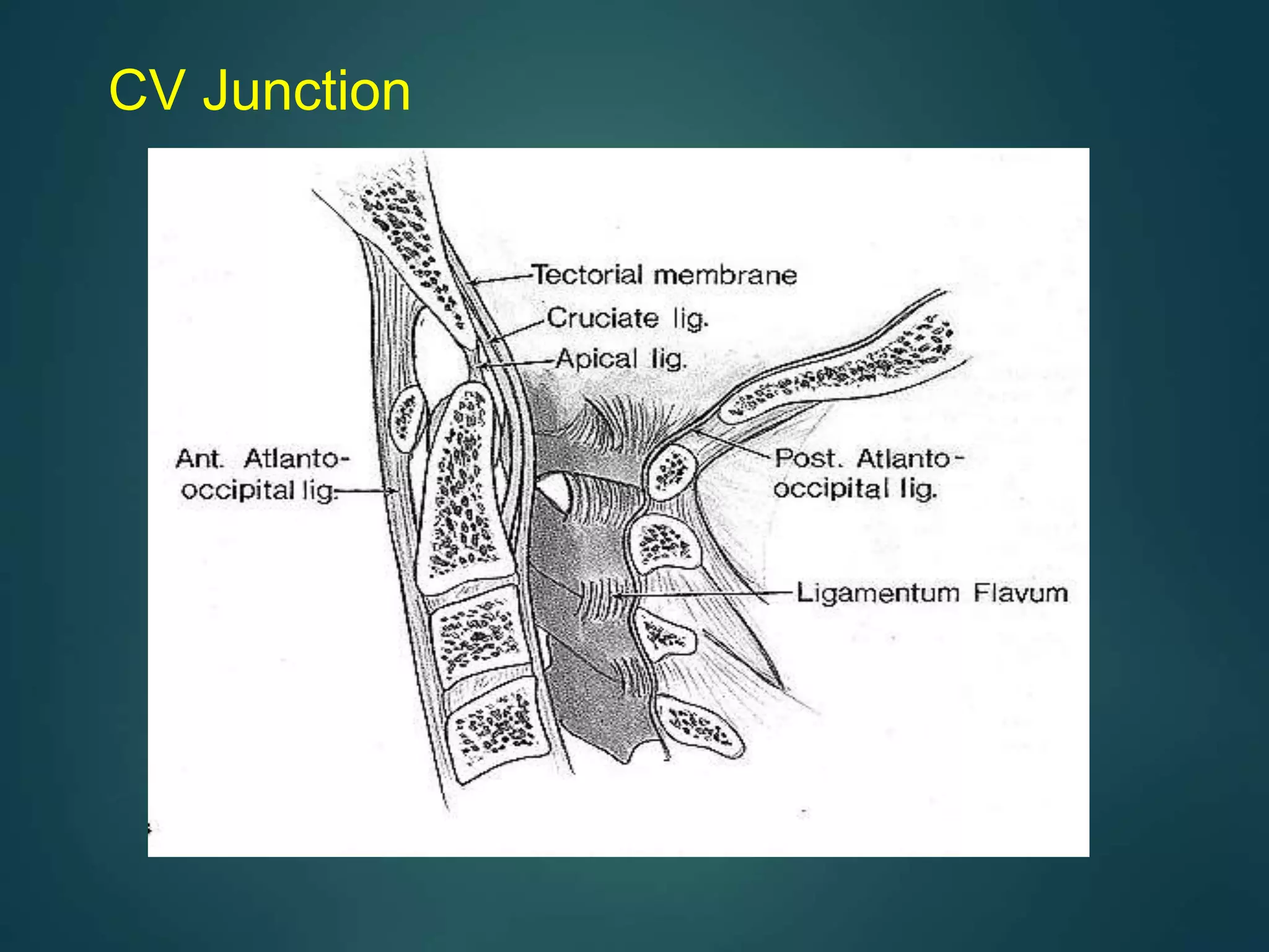 CRANIOVERTEBRAL JUNCTION ANATOMY, CRANIOMETRY, ANAMOLIES AND RADIOLOGY dr sumit verma | PPTX